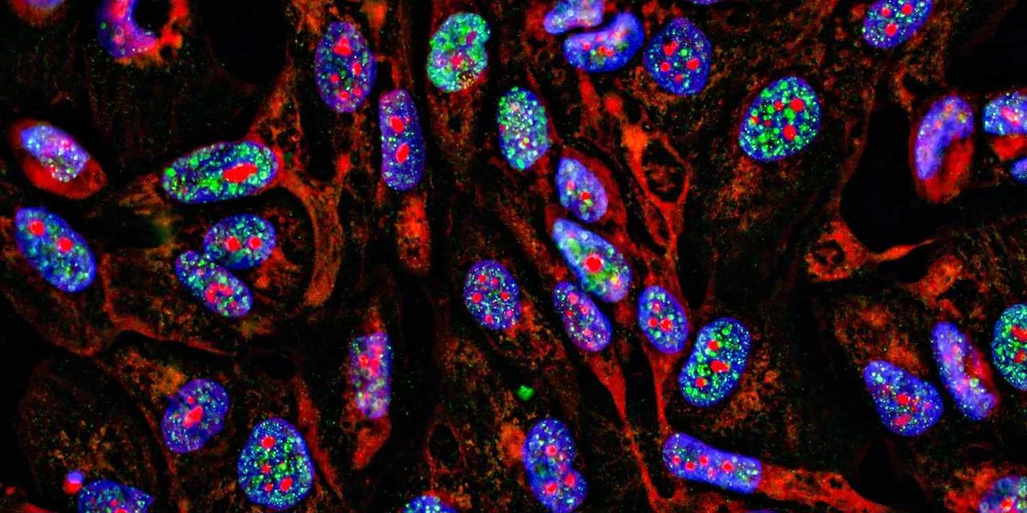 Perma-Shred: Unleashing Brown Fat’s Potential for Lasting Fat Loss ...