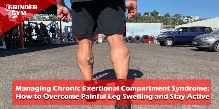 Managing Chronic Exertional Compartment Syndrome: How to Overcome Painful Leg Swelling and Stay ...